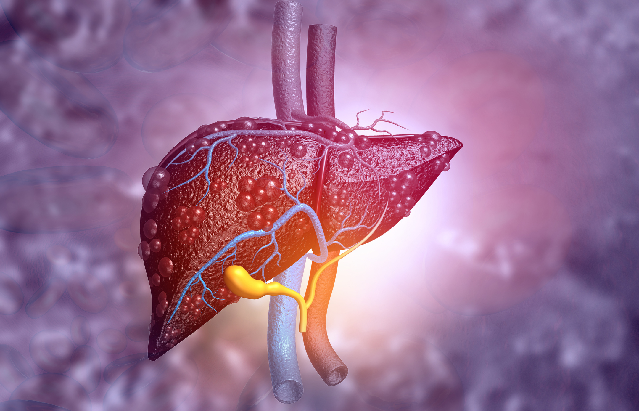Liver Function and Alpha-1: An Overview - AlphaNet